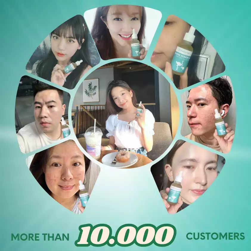 Dermalab Emu Renew Serum, Pitted Scar Treatment Serum, Safe for Skin | Shopee Philippines