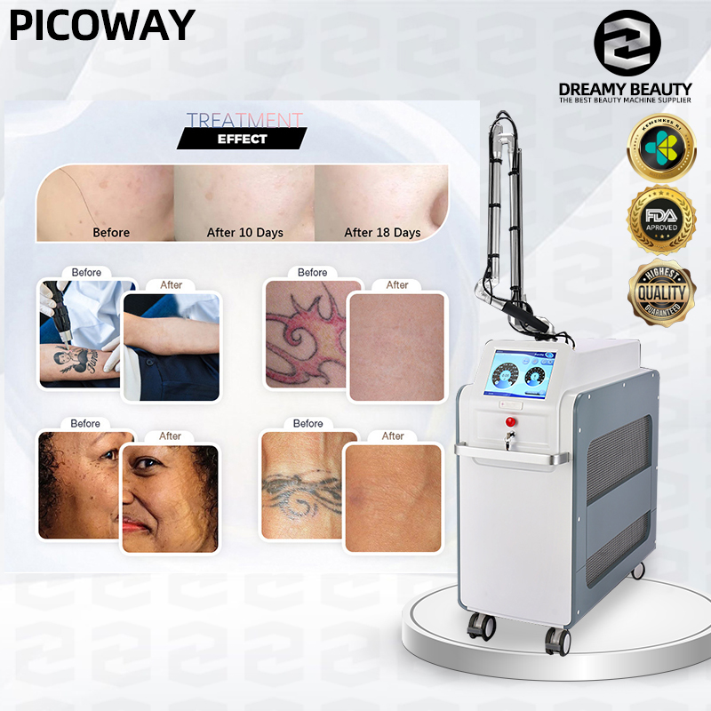 ⭐Manila showroom⭐Picoway Pico laser machine laser tattoo removal nd yag picosecond beauty ...