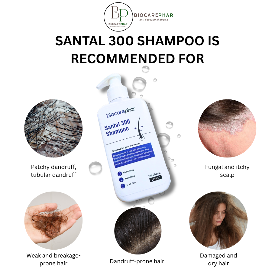 Biocare Santal 300 Herbal Shampoo (200ml) – A hair growth-stimulating ...