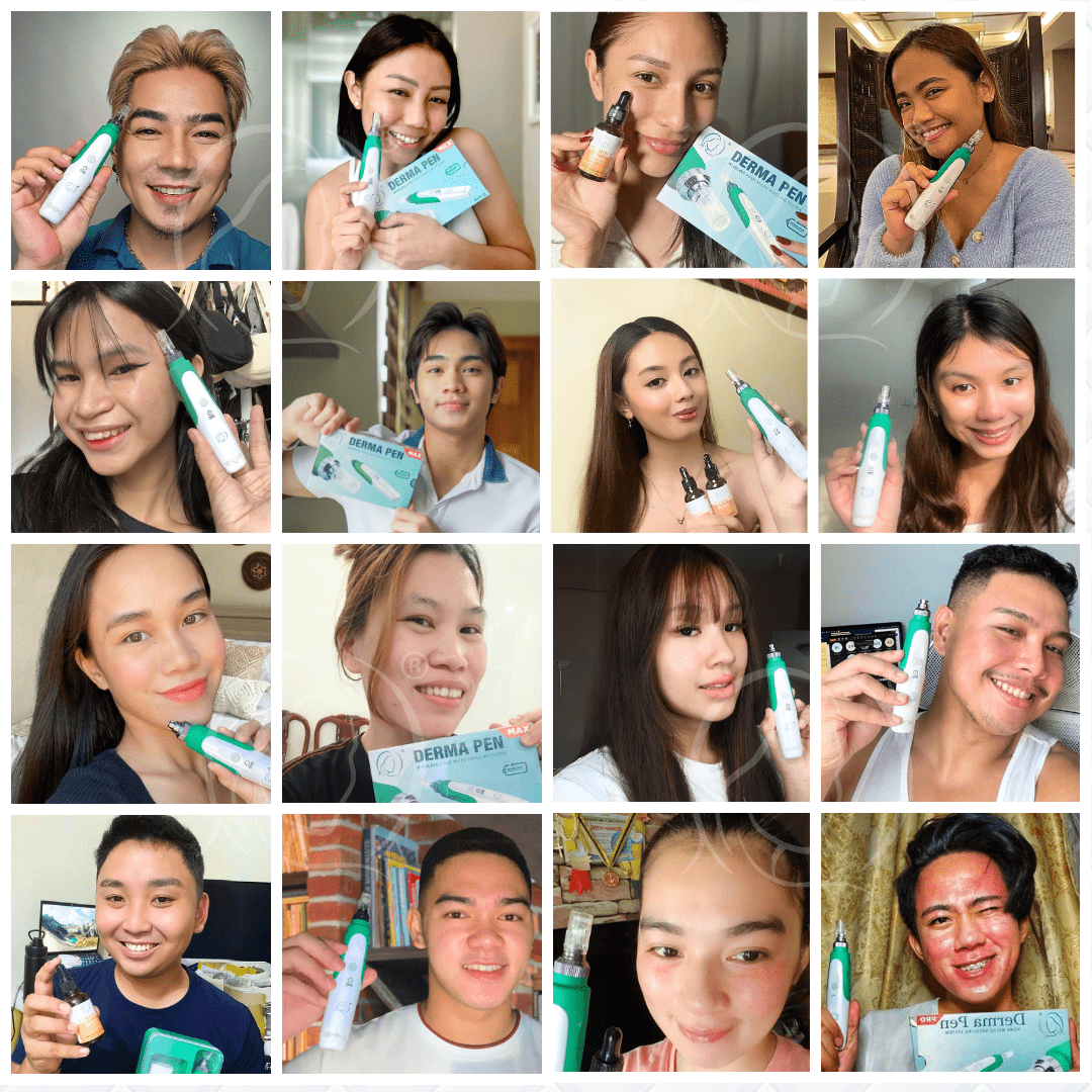 [PROMO] Derma Pen PACKAGE [PRO | MAX] by Derma Roller Philippines ...