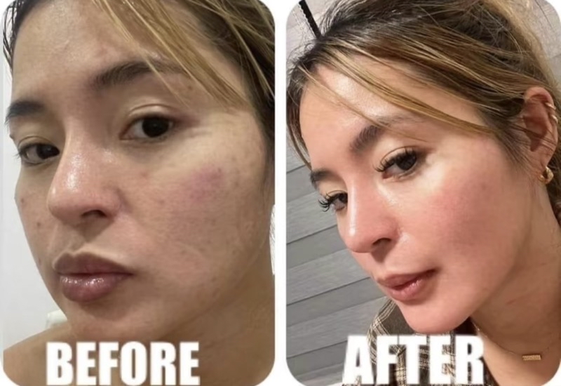 MS. TSUNG ESSENTIALS Demure Rejuve Set Lotion Big Toner Foam Wash Retinol Serum Glow Mist ...