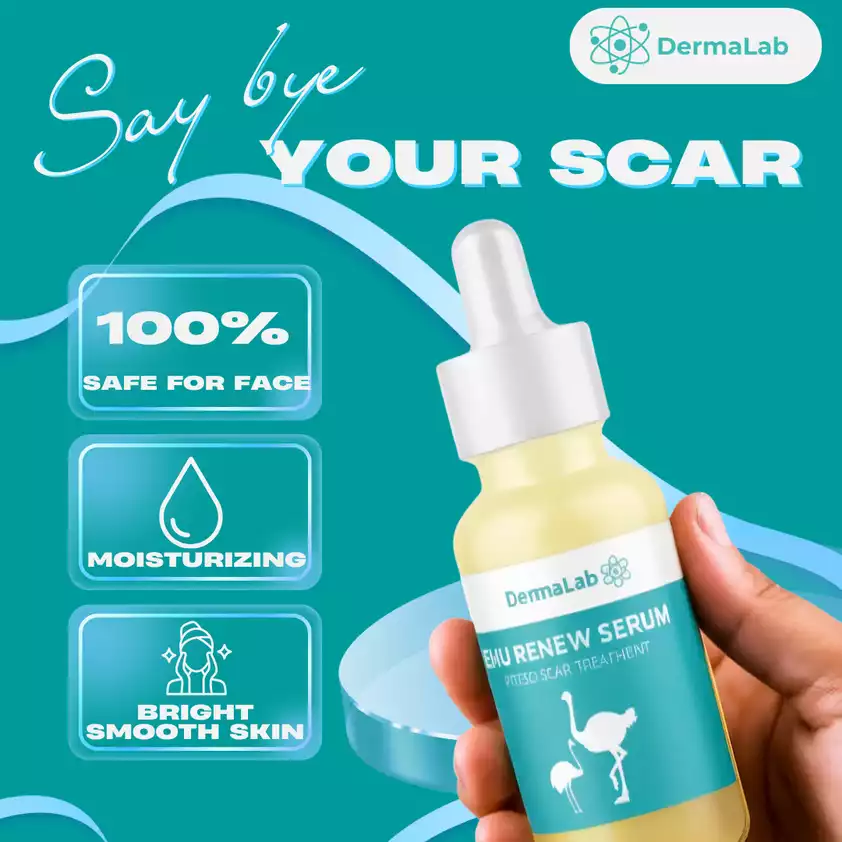 Dermalab Emu Renew Serum, Pitted Scar Treatment Serum, Safe for Skin | Shopee Philippines