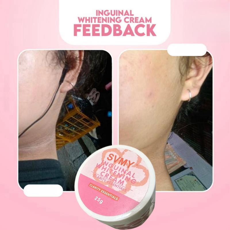 Inguinal Whitening Cream 25g – Brightens Dark Areas, Softens Skin ...