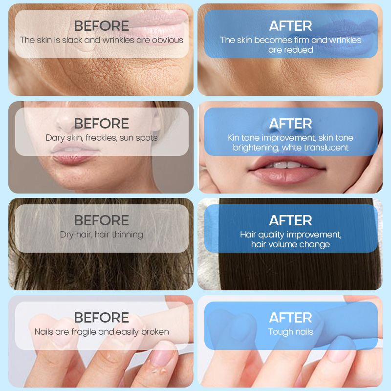 9 Young Basic Hydrolyzed Collagen Peptide 38mg+Vitamin C+Niacin for ...