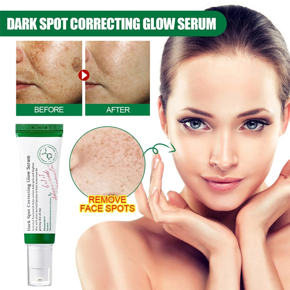 AXIS-Y Dark Spot Correcting Glow Serum Dark Spots Whitening Serum ...