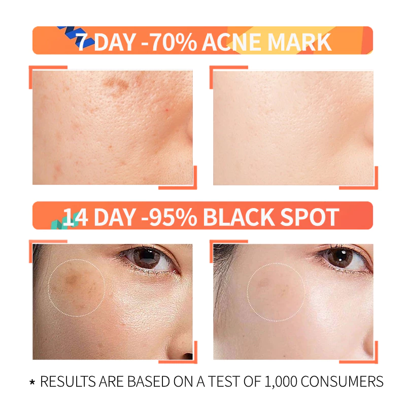 AXIS-Y Dark Spot Correcting Glow Serum Dark Spots Whitening Serum ...