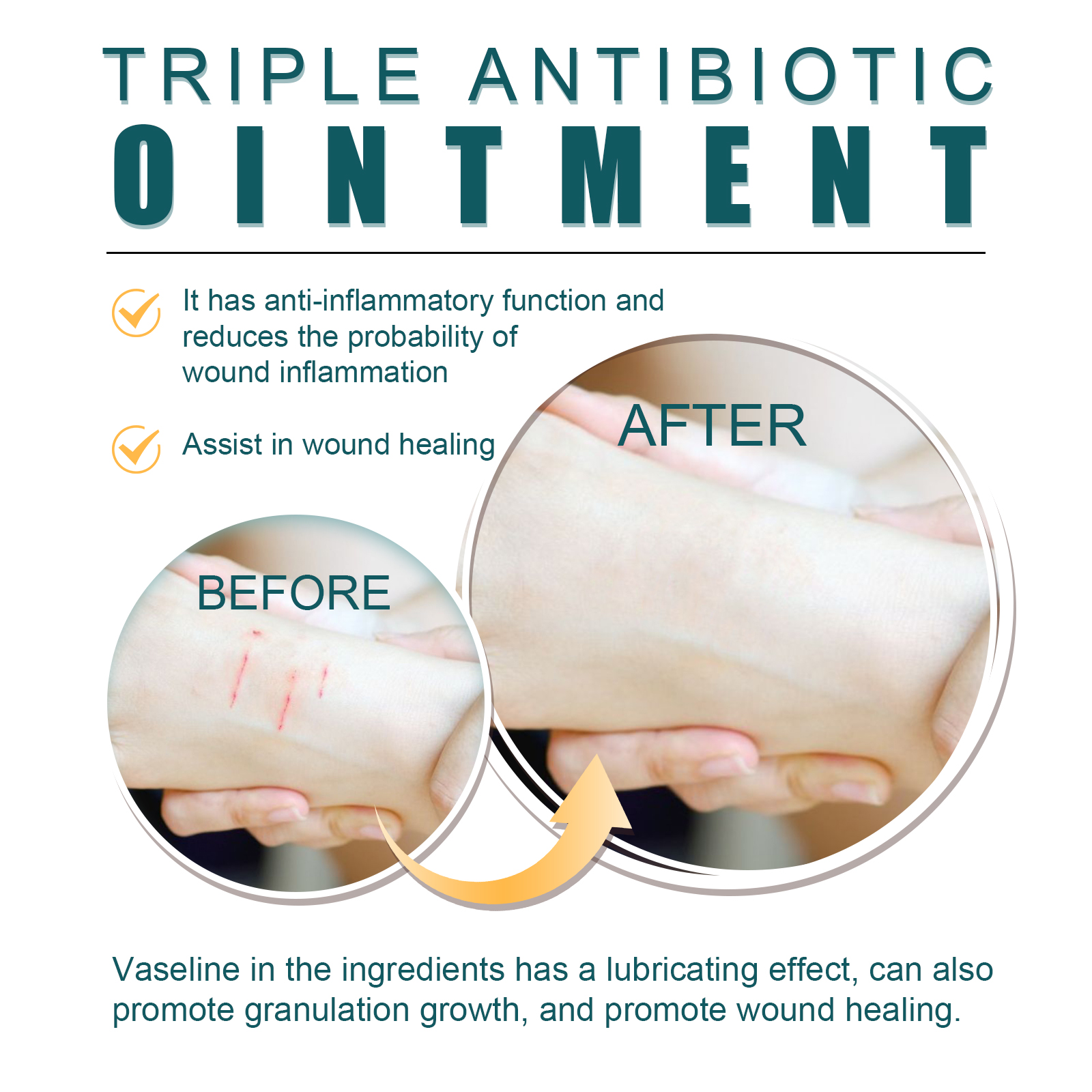 XIMONTH Antibiotic Ointment for Wound Healing and Infection Prevention | Shopee Philippines