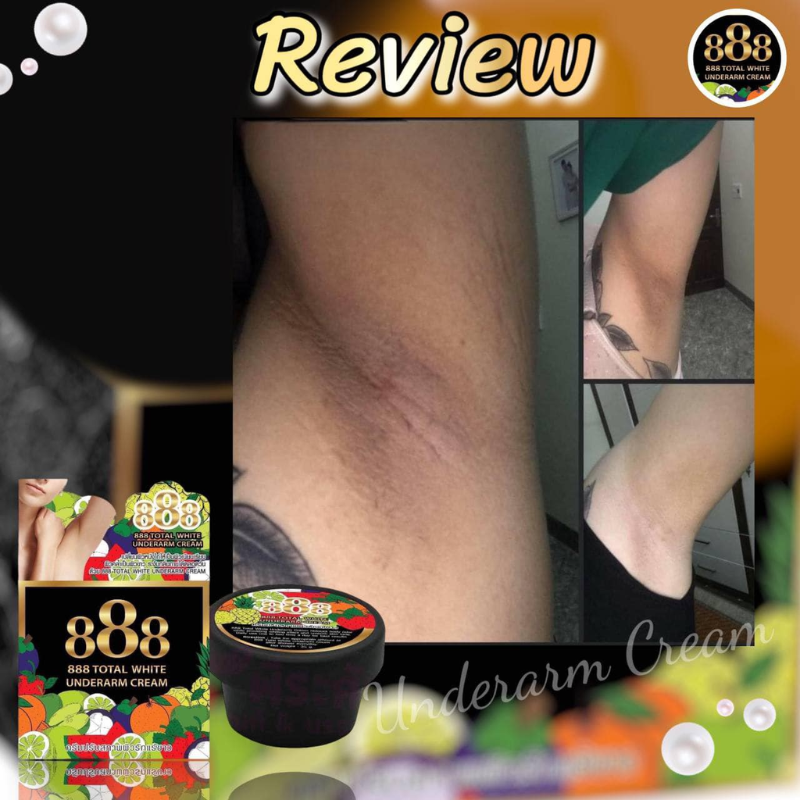888 TOTAL WHITE Imported Thailand Underarm Cream Whitening Body Lotion ...