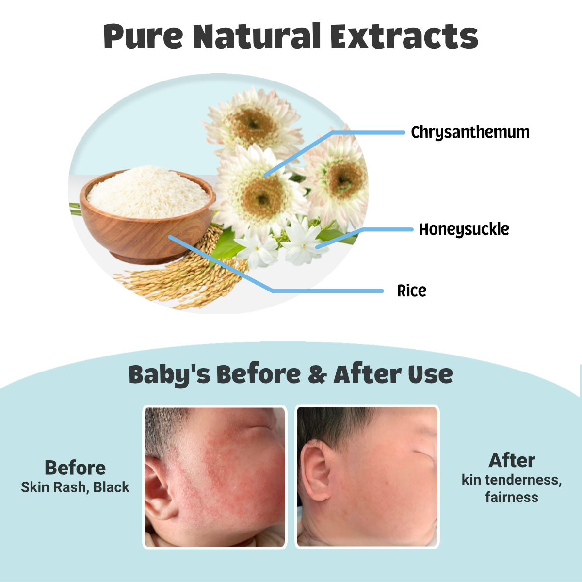 Hegerbaby Lotion + Lip Balm + Hair Oil - Relieves Prickly Heat & Saliva ...