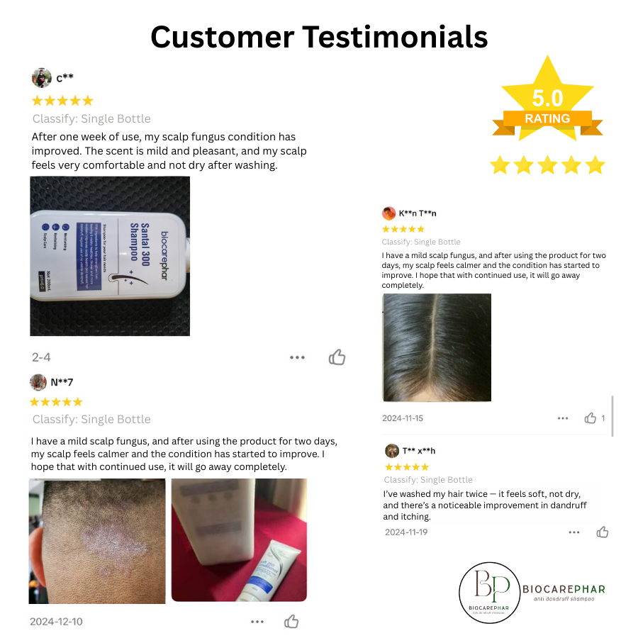 Biocare Organic Shampoo - Natural shampoo for scalp fungus and dandruff ...