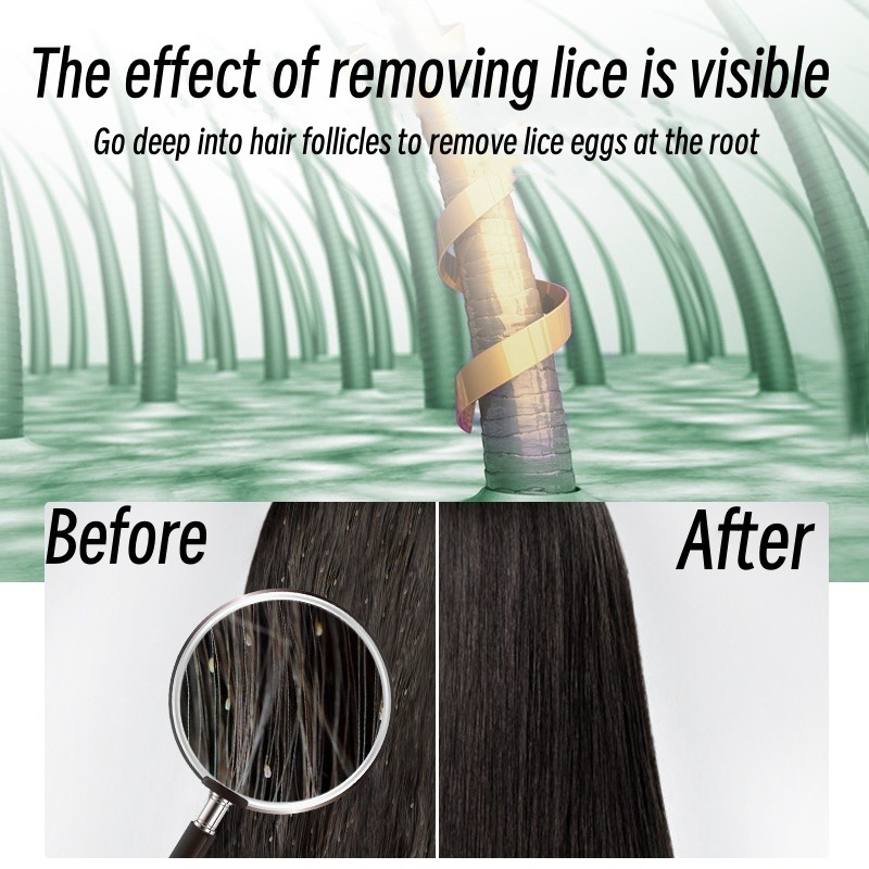 100mL lice remover shampoo Licealiz Head Lice Treatment Shampoo ...