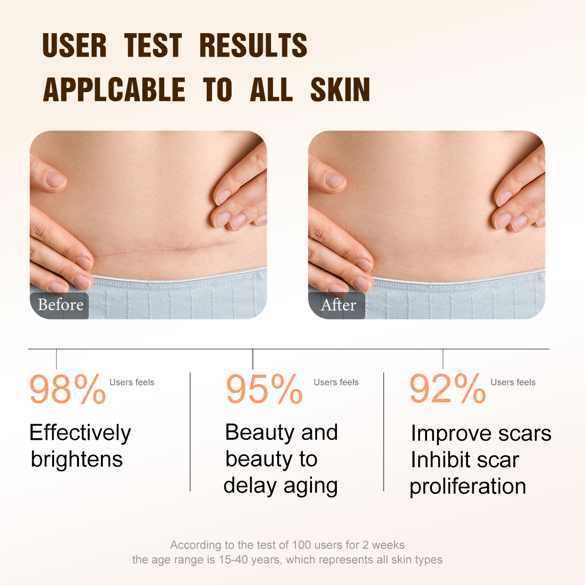 WORADA Scar-minator Scar Remover Body Care Lotion Moisturizing Diminish ...