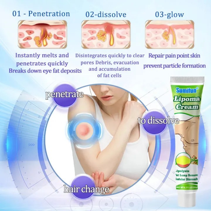 20g Lipoma Removal Care Cream is a safe ointment for repairing fat ...