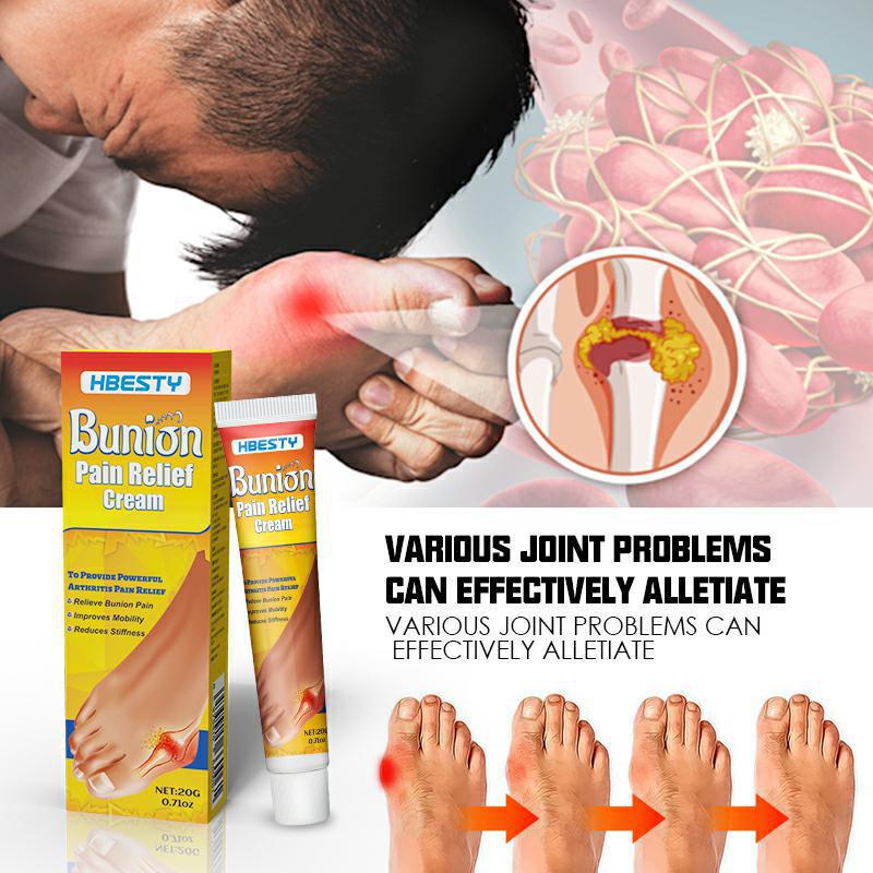 【Ready Stock】Bunion Pain Relief Cream Back Pain Reliever Arthritis ...