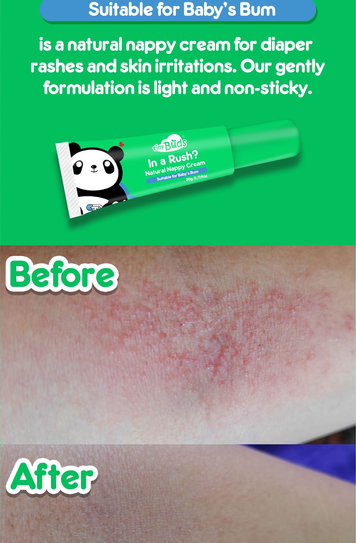 Tiny Buds In a Rush - Diaper Rash Cream (formerly known as In A Rash ...