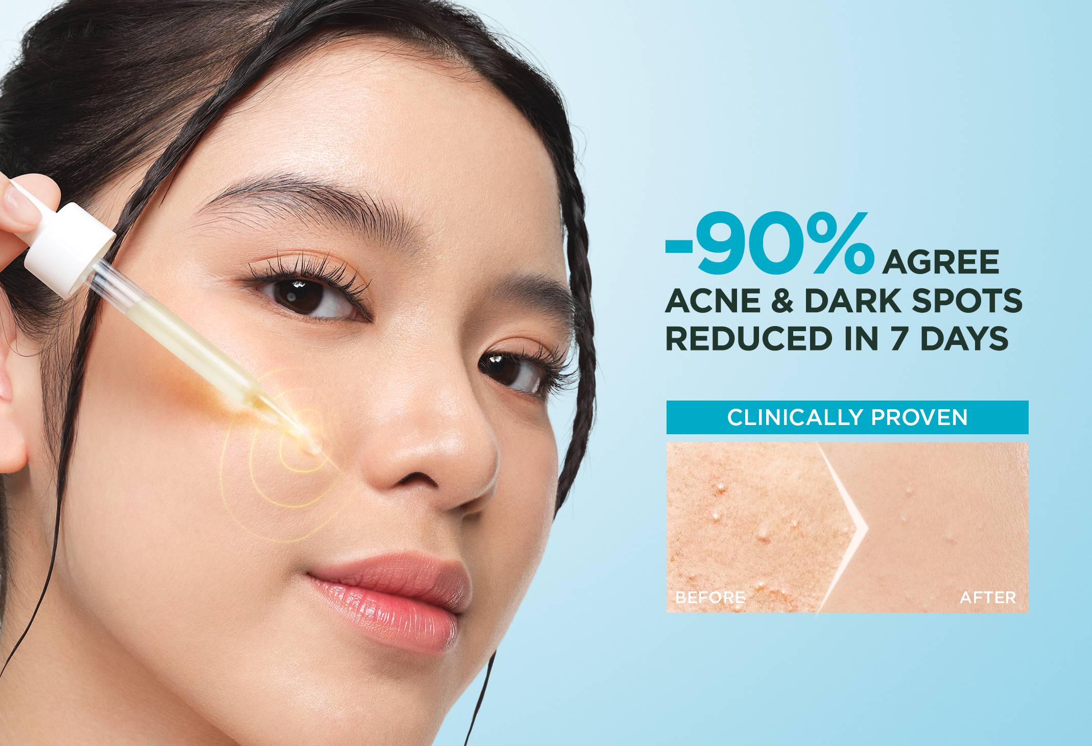 Garnier 4% Salicylic Acid Anti Acne Serum w/ Vitamin C, Niacinamide, AHA (15ml) - For pimples ...