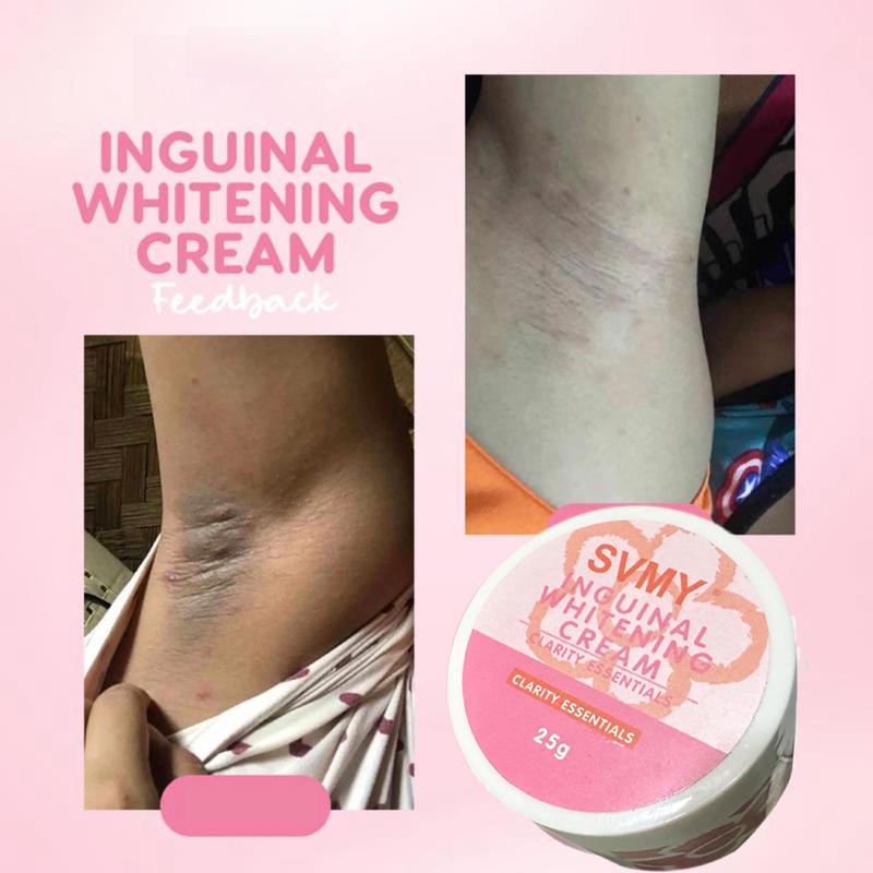 Inguinal Whitening Cream 25g – Brightens Dark Areas, Softens Skin ...