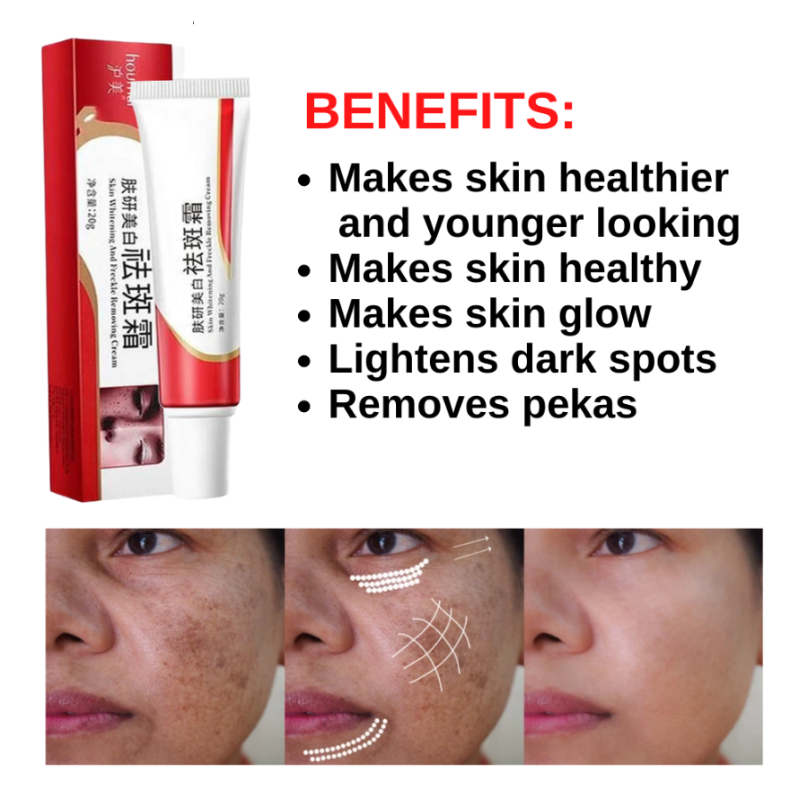 Pekas Remover Effective Melasma Cream 20g Anti Freckle Collagen Skin ...