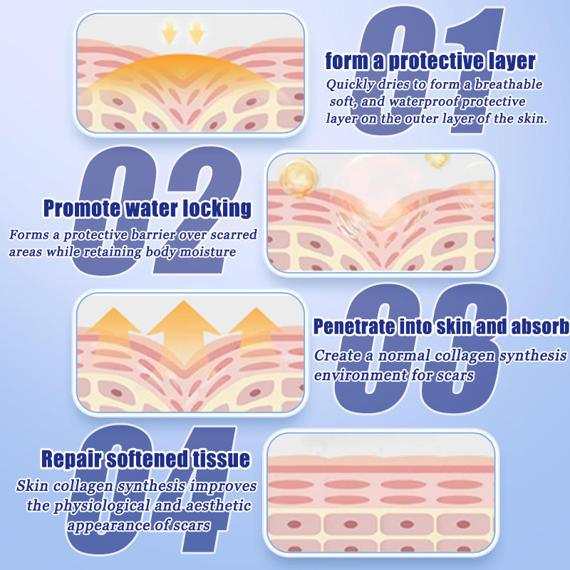 SOL LORA 30g pimple remover cream keloid scar cream remover original ...