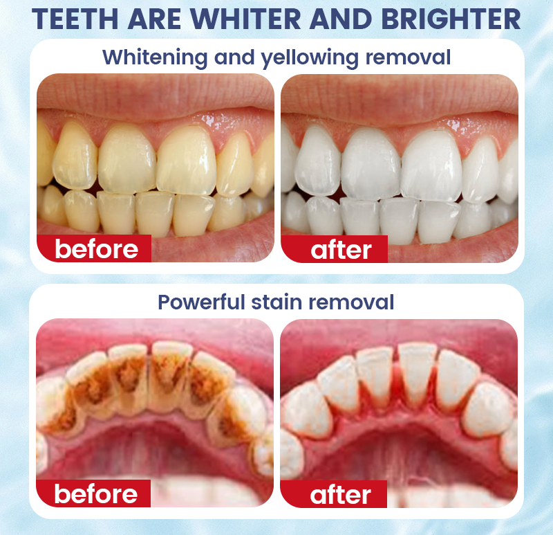 Japanese Teeth Whitening Toothpaste Peppermint Food Graded Family ...