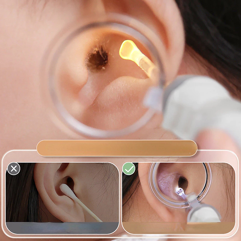 Baby Ear Cleaner With Led Light Infant Ear Wax Cleaner Picker With ...