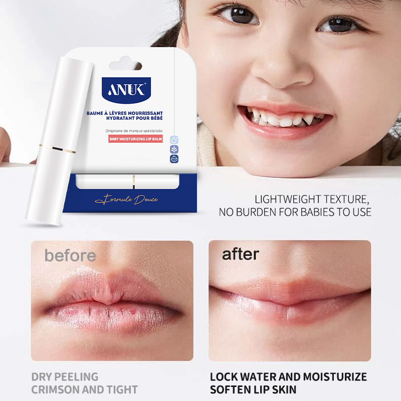 Baby Lip Balm Moisturizing And Nourishing To Relieve Saliva Rash ...