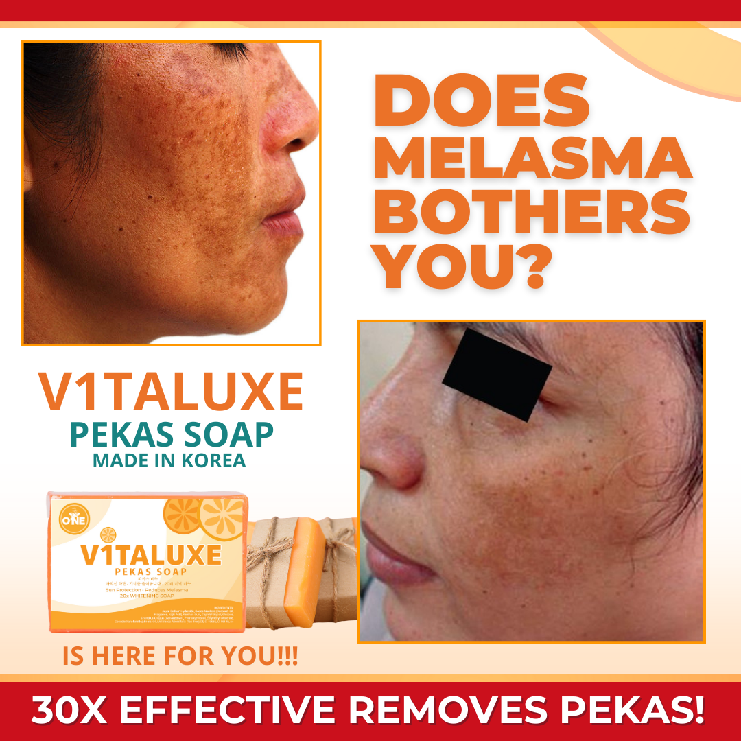 V1taluxe Pekas Melasma Soap(100g)-Dark Spots,Melasma,Pekas ...