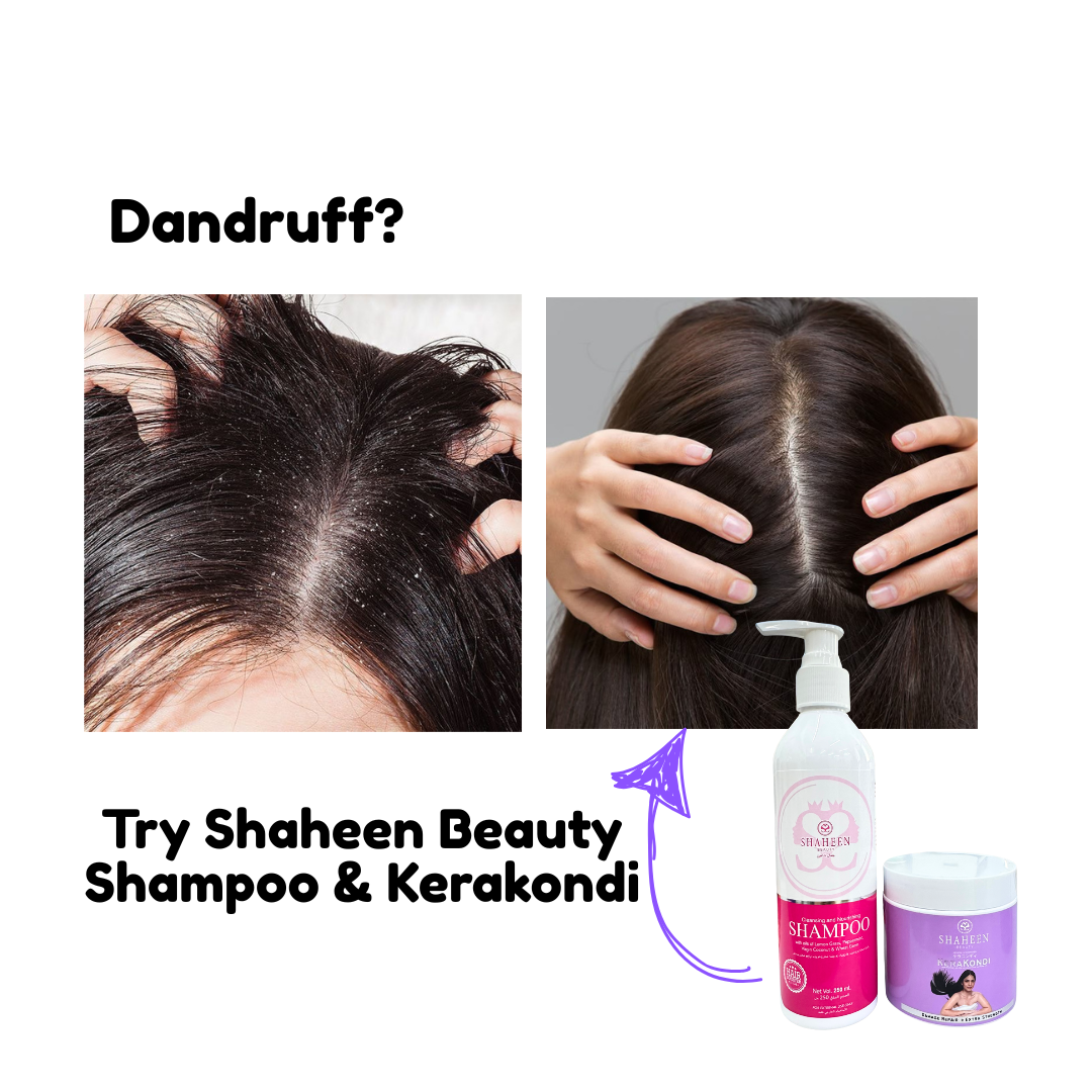 SHAHEEN BEAUTY Anti Dandruff Shampoo 500 ml Shampoo Para Sa Kuto At ...