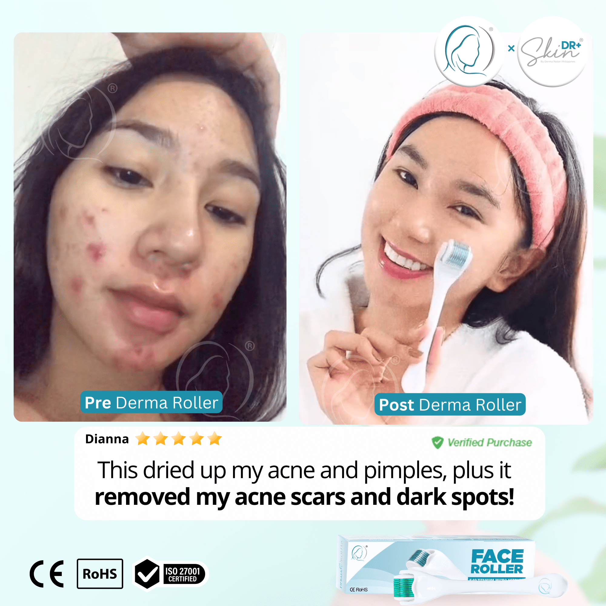 [45% OFF] Original Dermaroller by Derma Roller Philippines For Face and ...