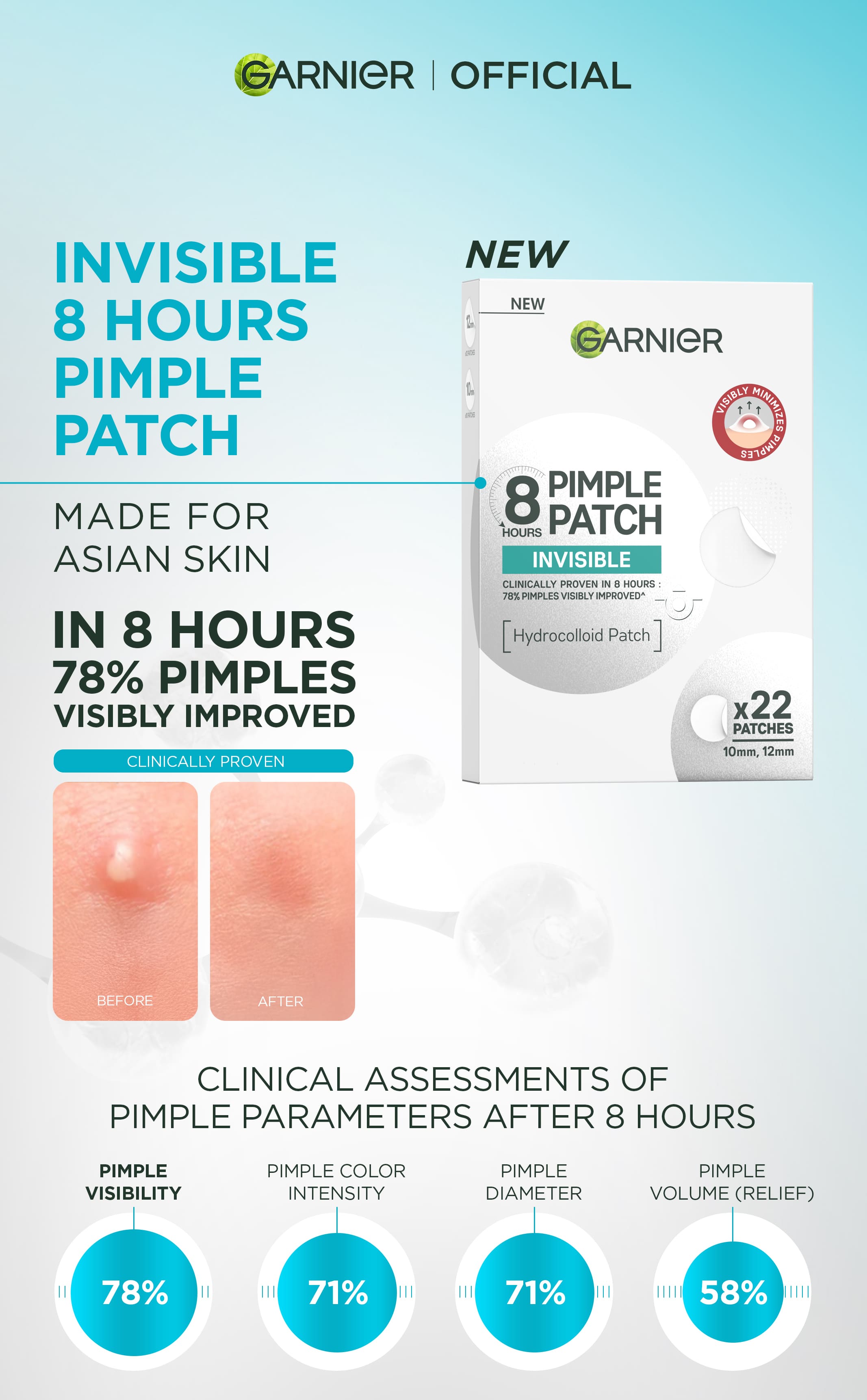 NEW Garnier Invisible Pimple Patch (22pcs.) | Shopee Philippines