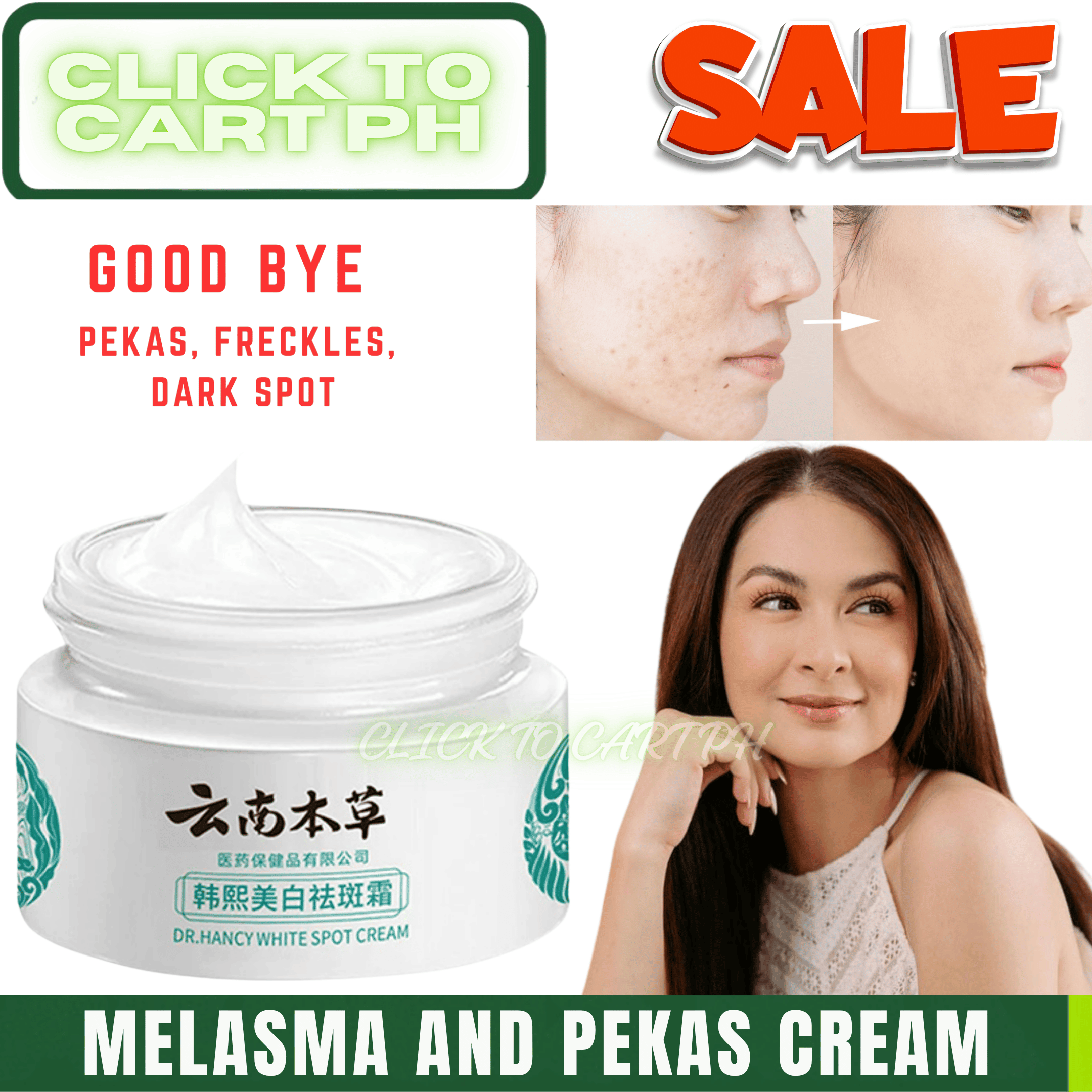Original Pekas Cream Remover & Melasma Cream Japanese Whitening Formula ...