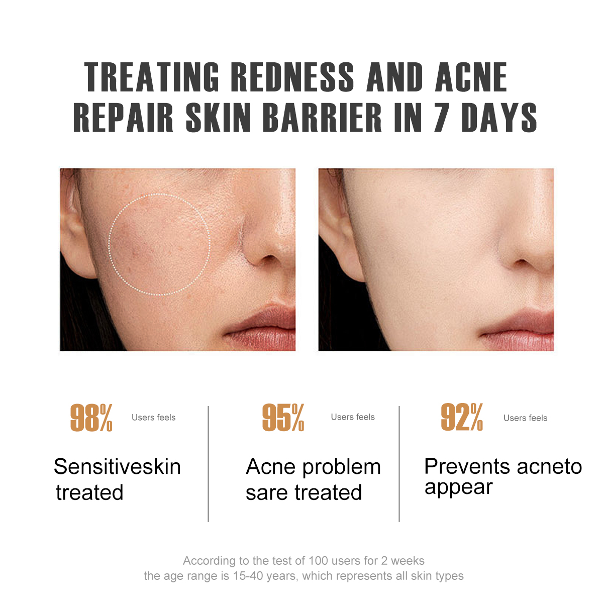 WORADA Vitamin C Toner High Concentration Brightening+Antioxidant ...
