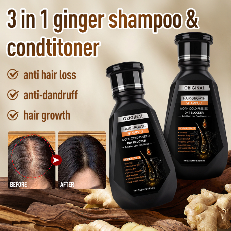 Ginger Shampoo Minoxidil Hair Growth Thickener Anti Hair Loss for Women ...