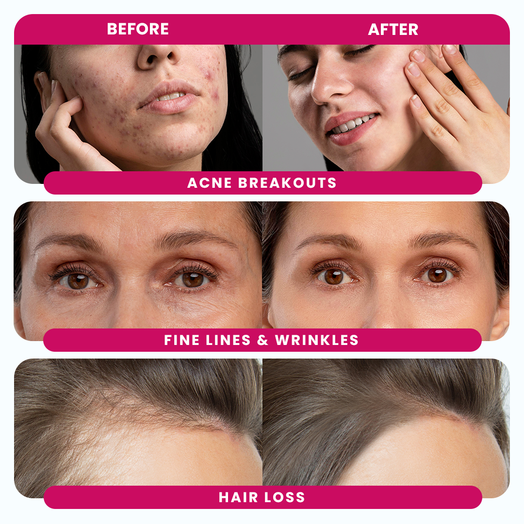 OSwell Collagen Maxx (180 Tablets – Super Value) Anti-Aging, Whitening ...