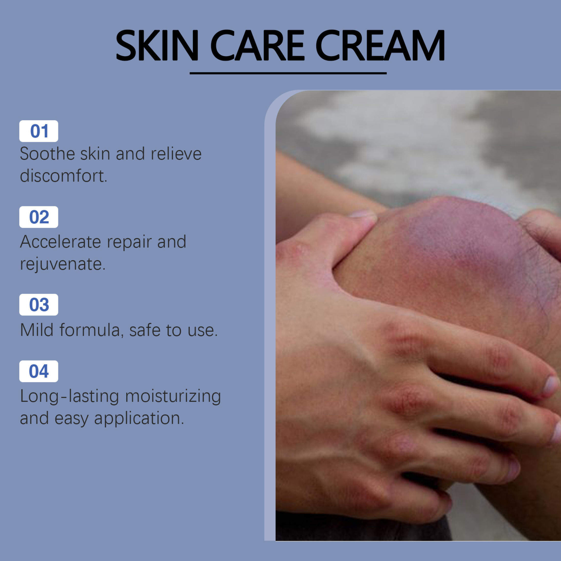 Bruising Treatment Cream Bruises Injury Swelling Pain Relief Cure ...