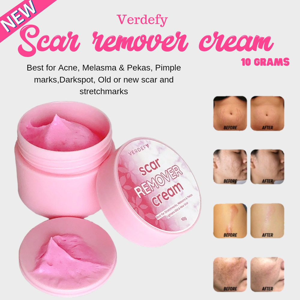 VERDEFY SCAR CREAM 10G FOR OLD & NEW SCAR KELOID STRETCH MARKS PIMPLE ...