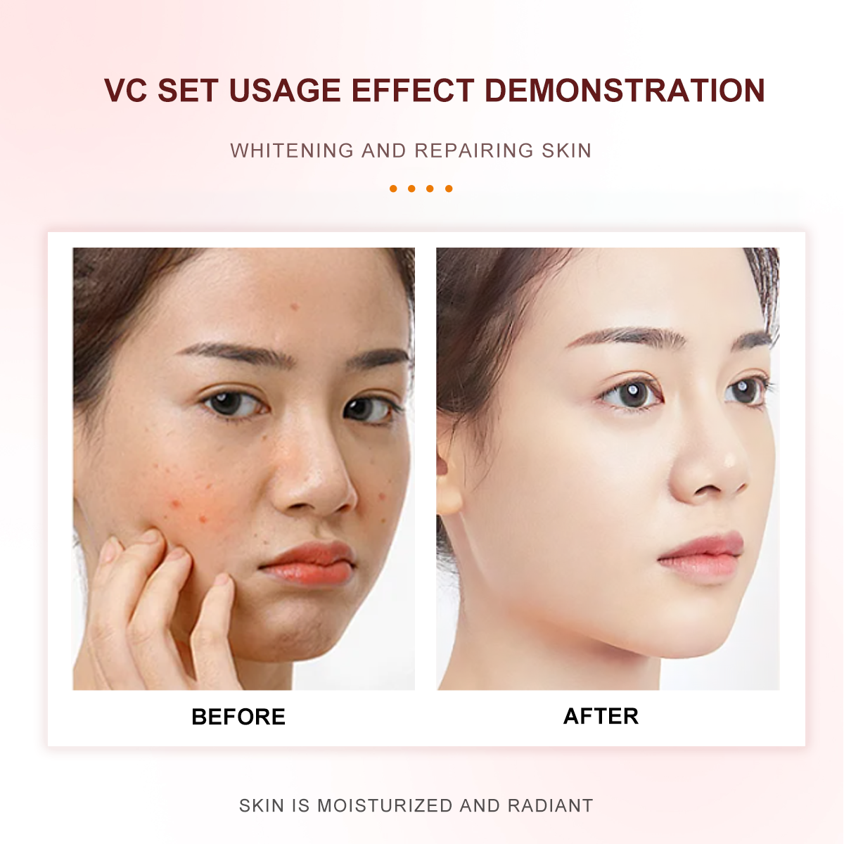 WORADA Vitamin C Facial Toner+ Foam Cleanser with Brush Hydrating ...