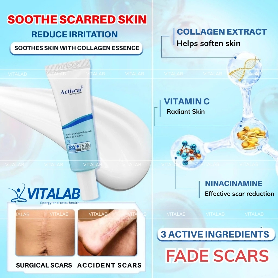 [BUY 1 GET 1] ACTISCAR 20G Scar Removal Cream - Smooth & Even Skin Tone ...