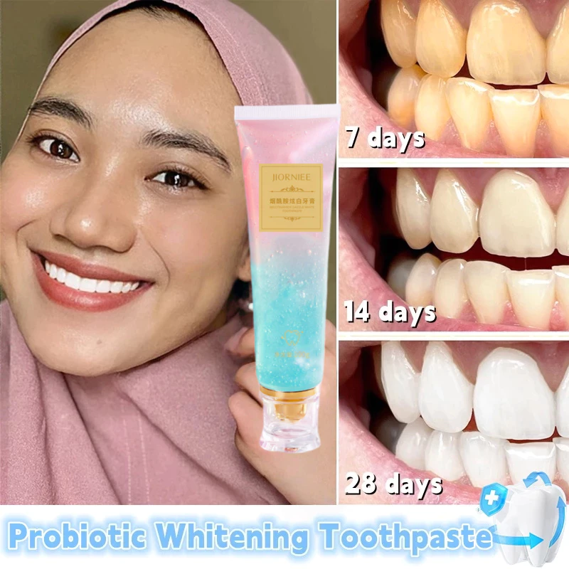 Whitening toothpaste for hygiene, cleanliness, fresh breath, yellow ...