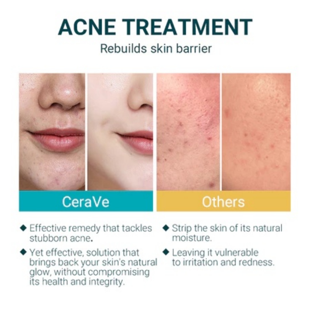 Moisturizing Cream repairs the skin barrier, soothes dryness and boosts ...
