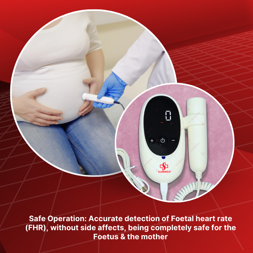 SURRMED Digital Fetal Doppler | Battery-Operated Baby Heartbeat Monitor ...
