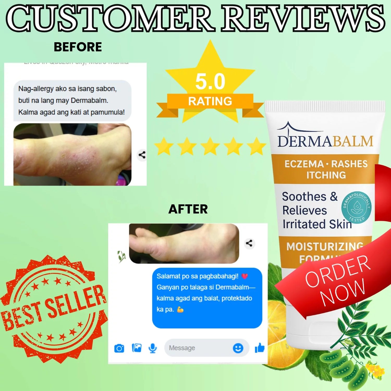 Derma Balm ECZEMA RASHES ITCHING Cream - 50g | Soothes & Relieves ...