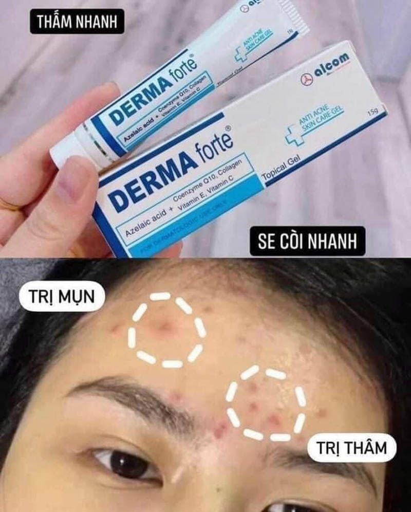 DERMA FORTE Topical Gel 15g (Azelaic Acid, Coq10, Collagen, Vit C and E ...