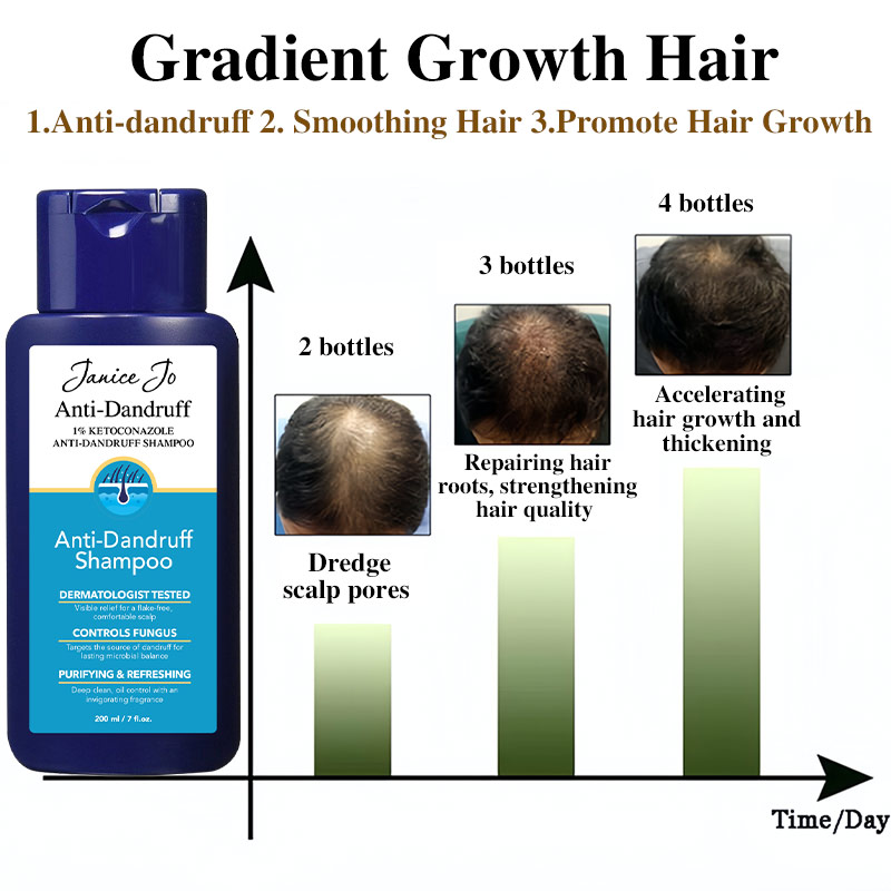 Hair Growth Set Shampoo Anti Dandruff Oil Conctrol + Saffron Hair Spray ...