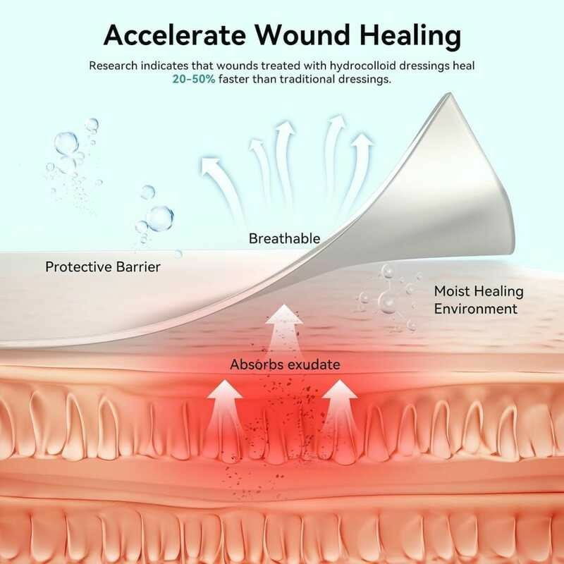 Tt Grade Hydrocolloid Sheet Roll – Cut-to-Fit Dressing for Wound Care ...