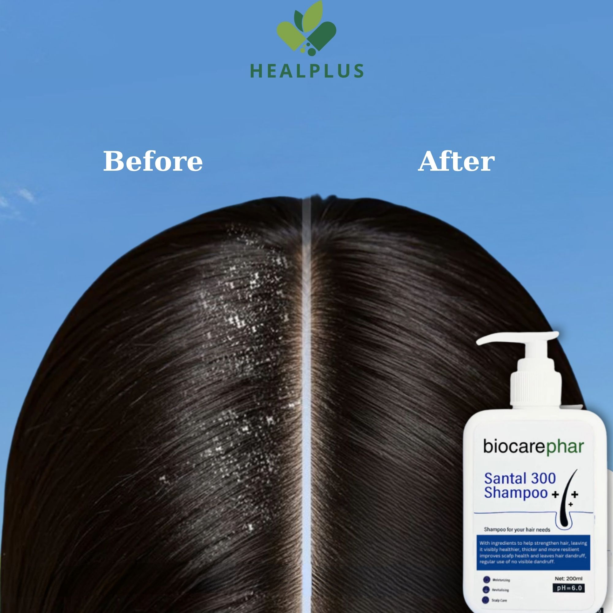 Biocare Santal 300 shampoo 200ml removes dandruff, fungus, hair fall ...