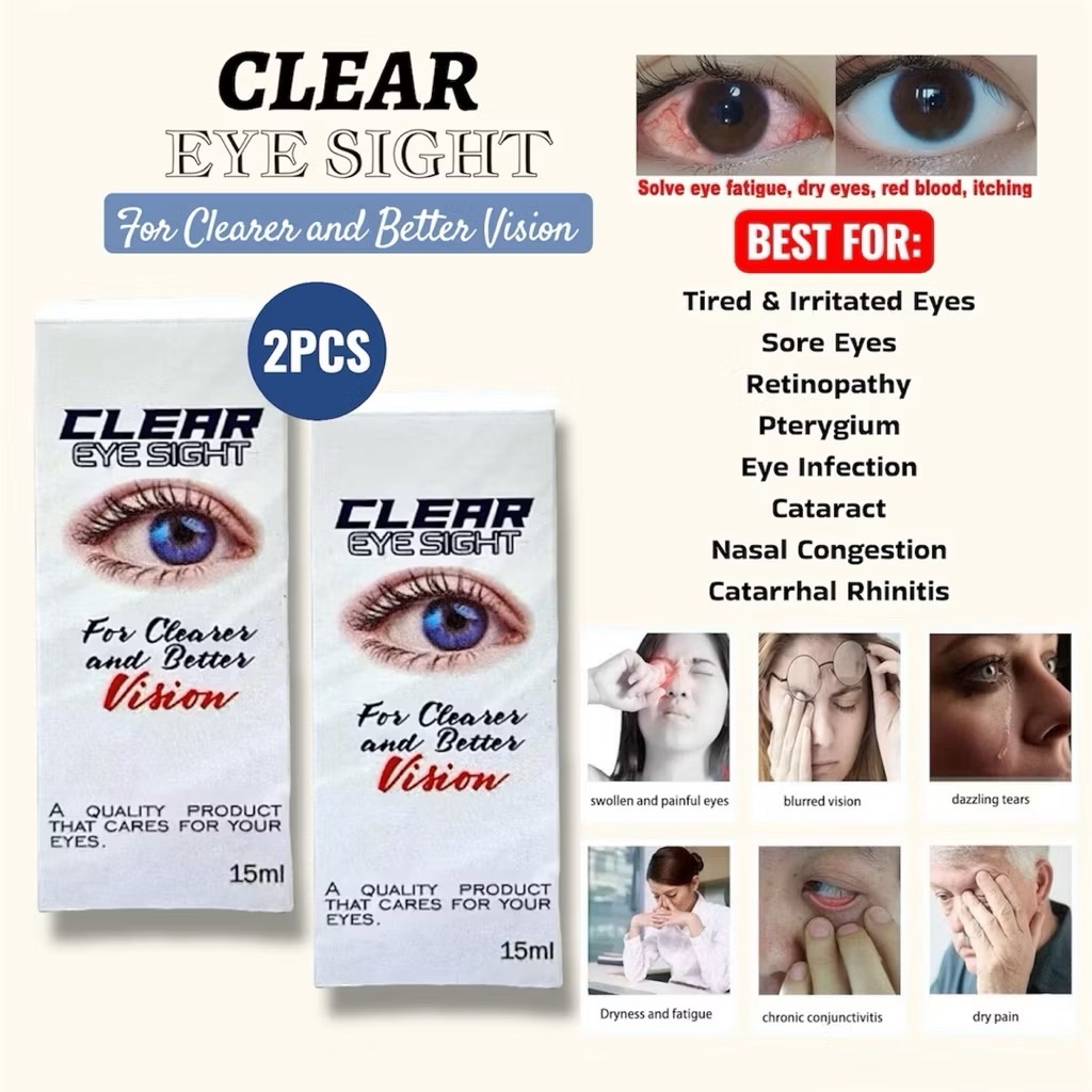 Vision Care Eye Refreshing drops | Shopee Philippines