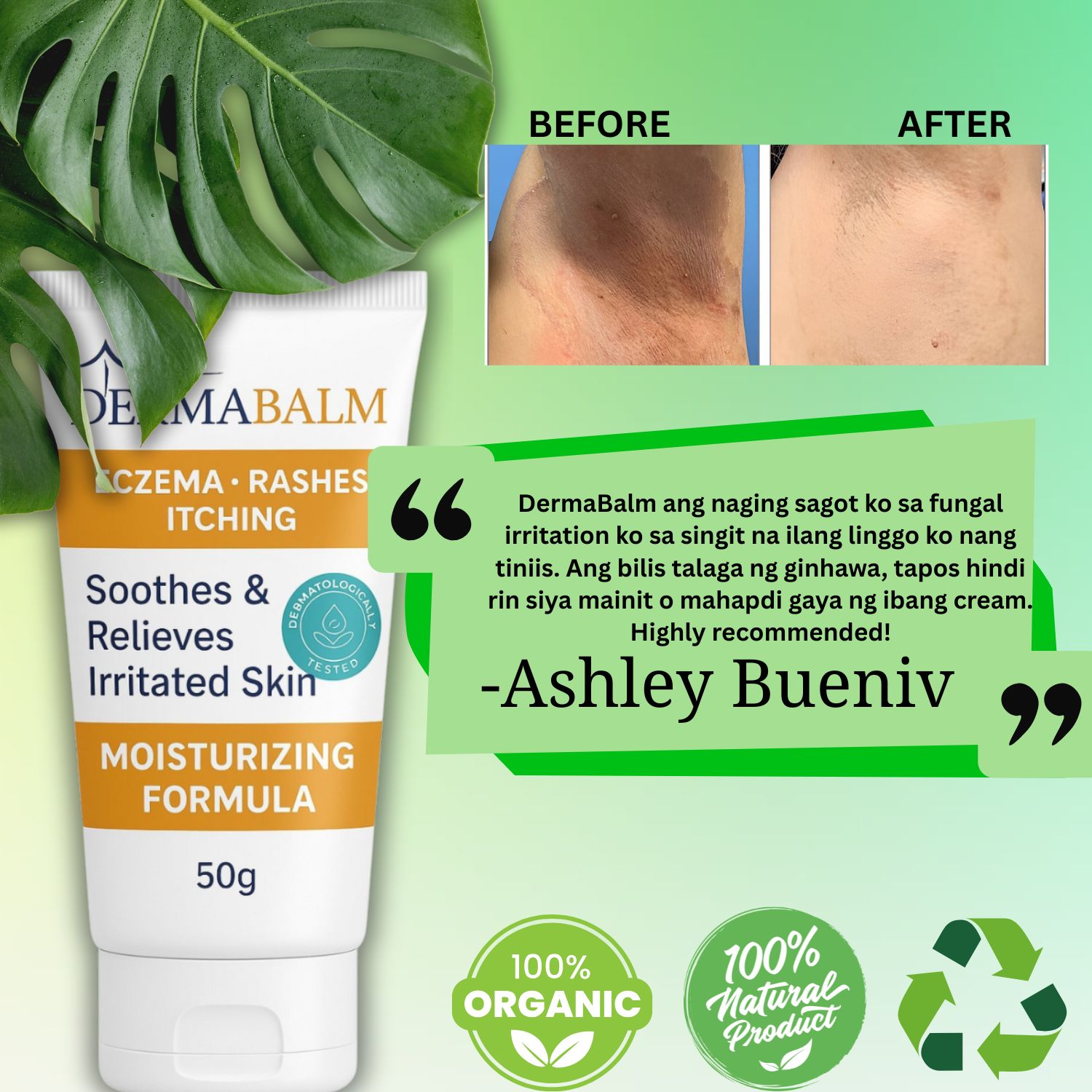 DermaBalm ECZEMA · RASHES ITCHING Cream 50g | No-Nirritant Moisturizing ...