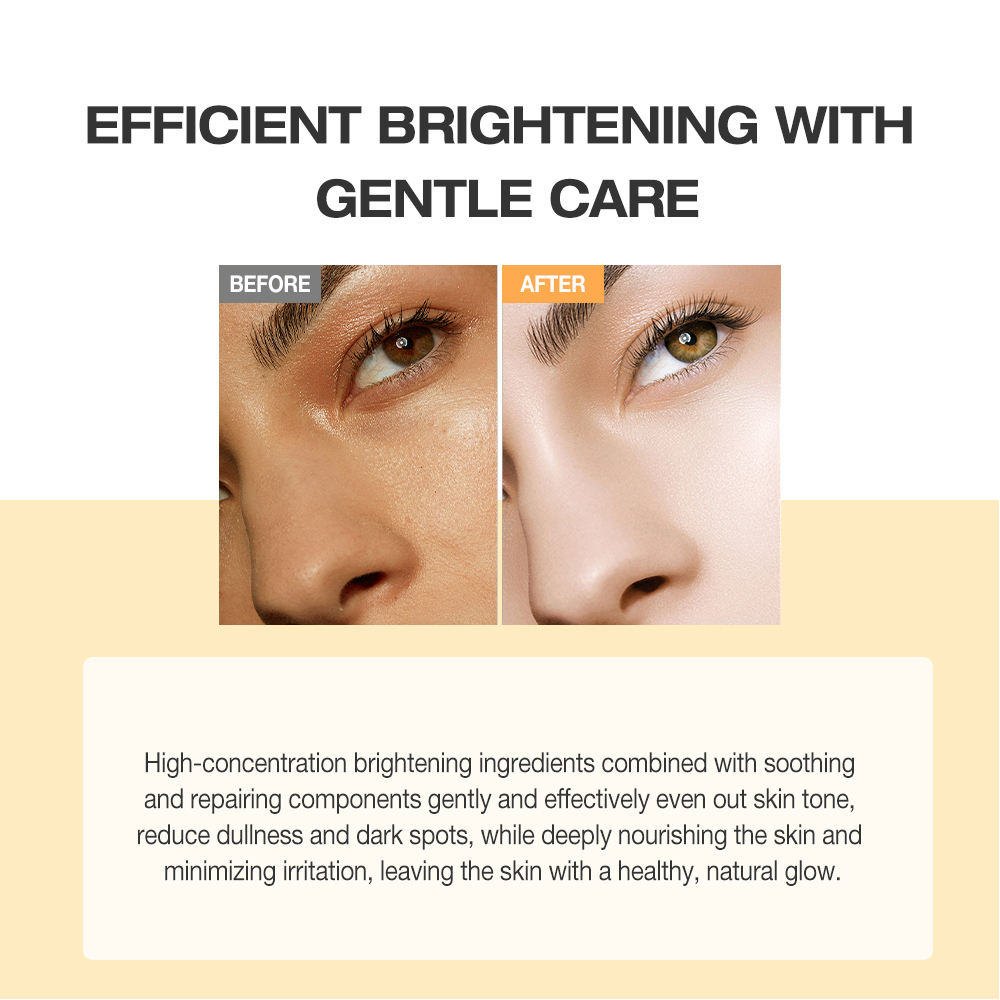 SKINEVER Nourishing Skincare Serum with Vitamin C for Brightening Face ...