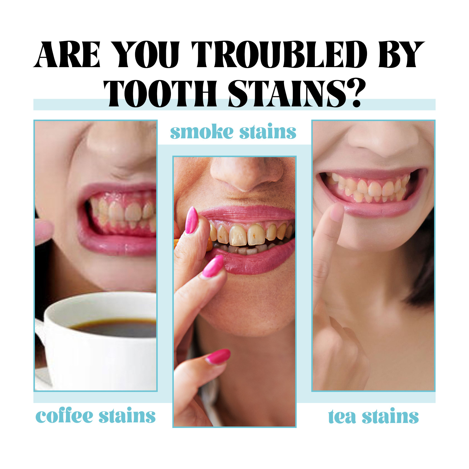 BUY 1 TAKE 1 Japan Scoban Vitamin C Probiotic Whitening Cream Powder ...